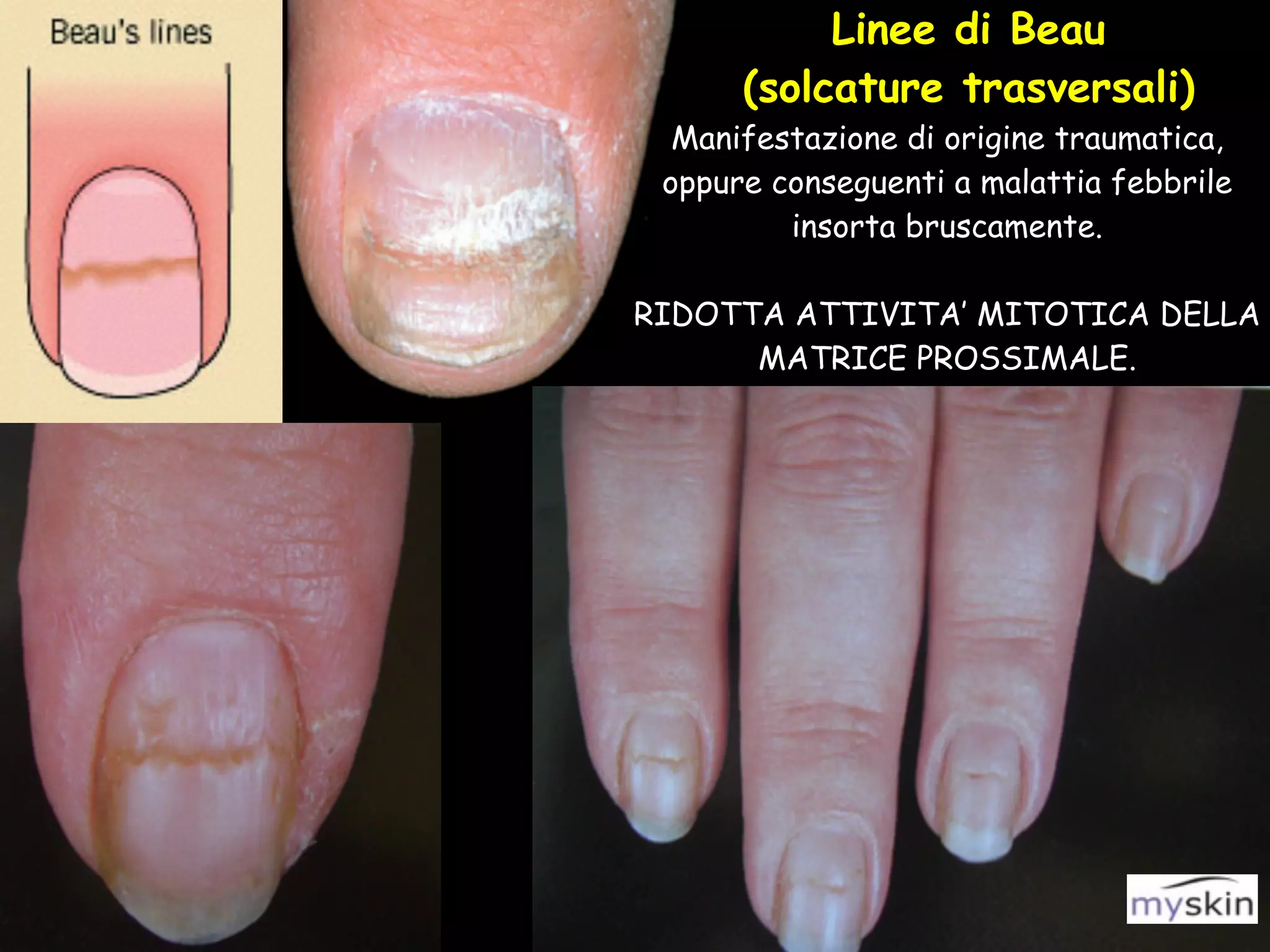 Unghia anatomia clinica | PDF