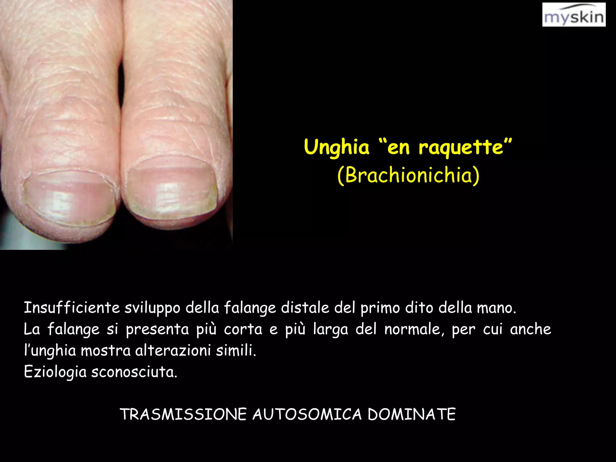 Unghia anatomia clinica | PDF