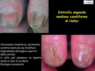 Unghia anatomia clinica | PDF