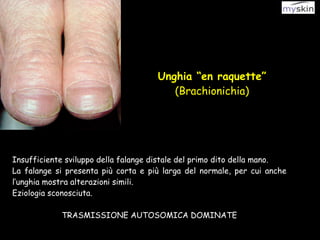 Unghia anatomia clinica | PDF