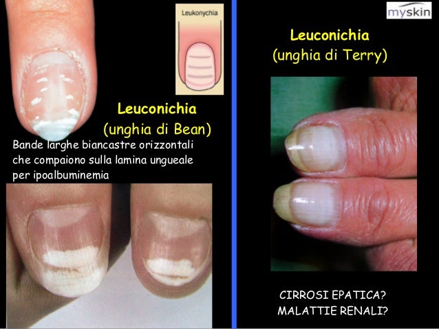 Unghia anatomia clinica