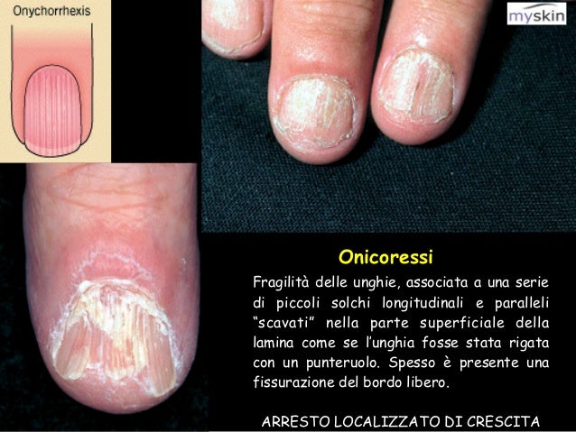 Unghia anatomia clinica