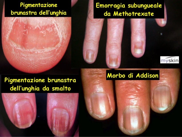 Unghia anatomia clinica