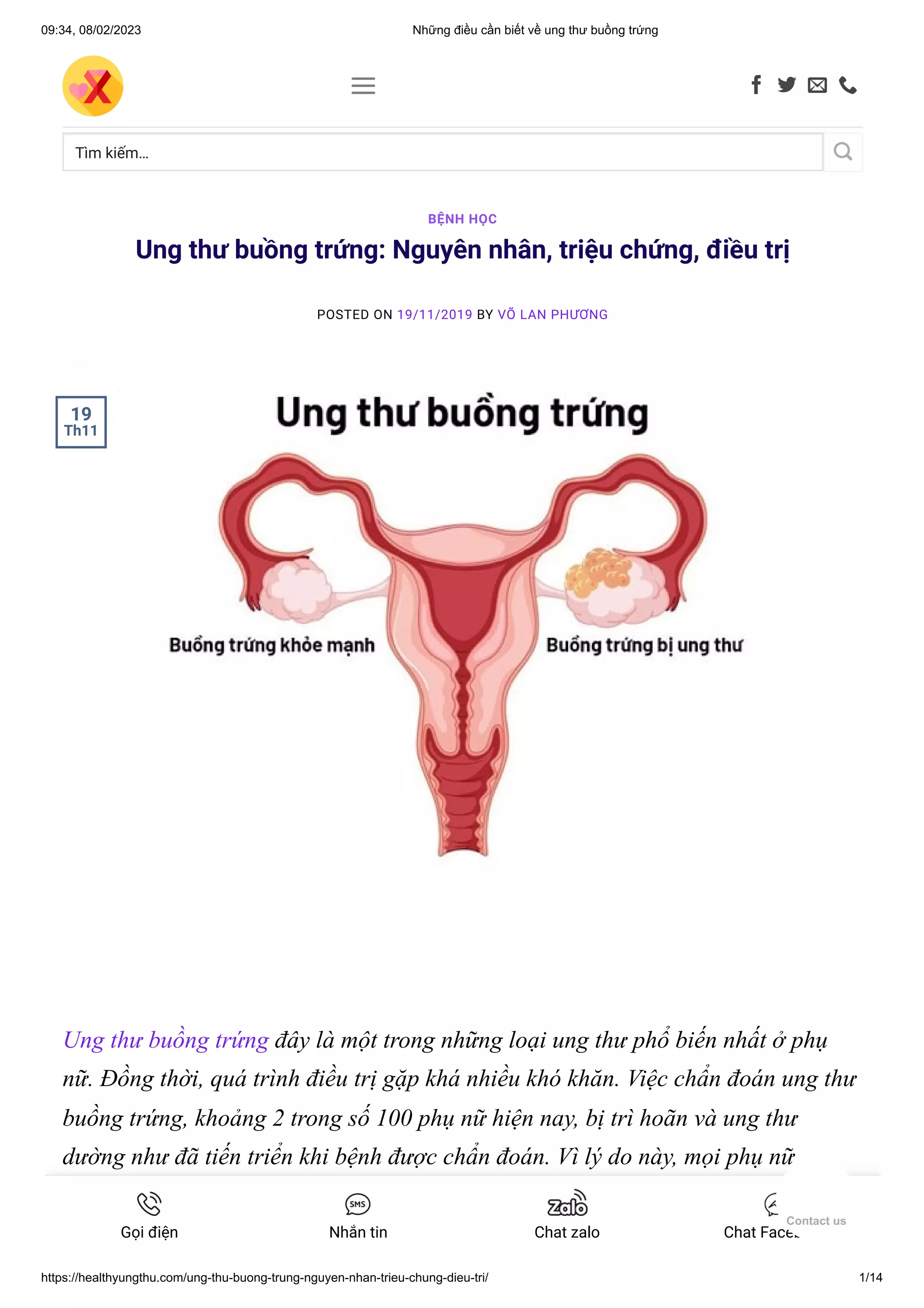 Ung thu buong trung Nguyen nhan dau hieu nhan biet.pdf