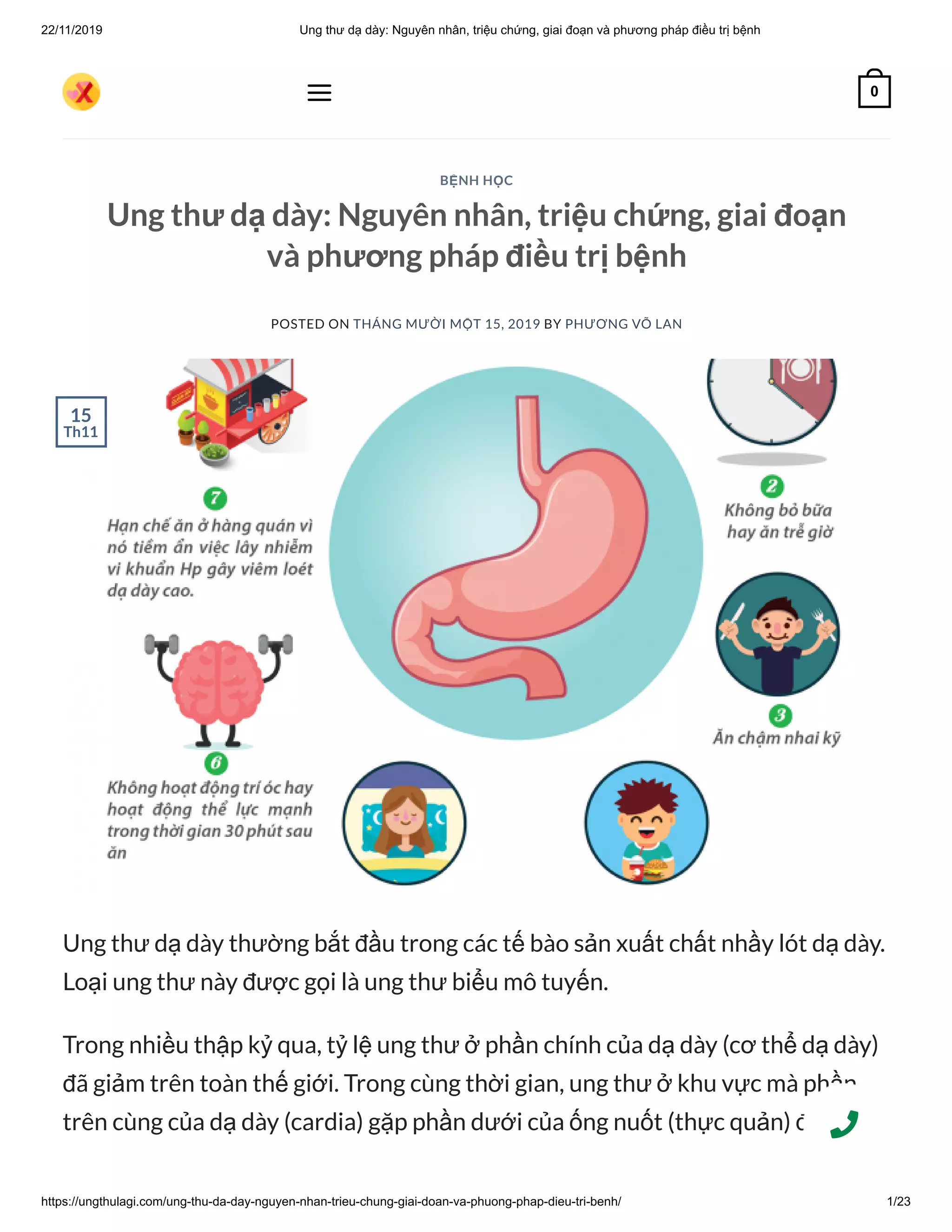 Ung thu da day nguyen nhan dau hieu trieu chung phuong phap dieu tri hieu qua nhat | PDF