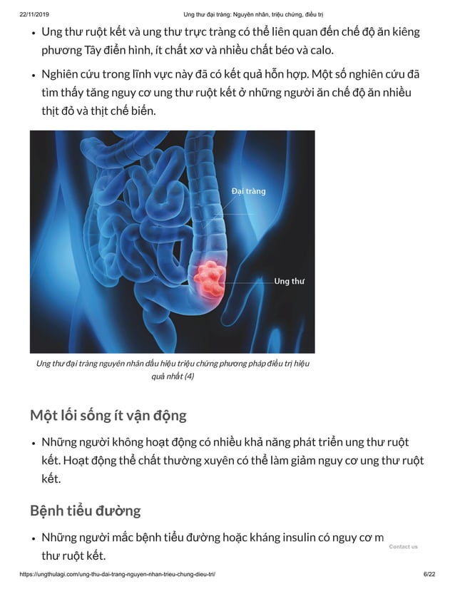 Ung thu dai trang nguyen nhan dau hieu trieu chung phuong phap dieu tri hieu qua nhat | PDF