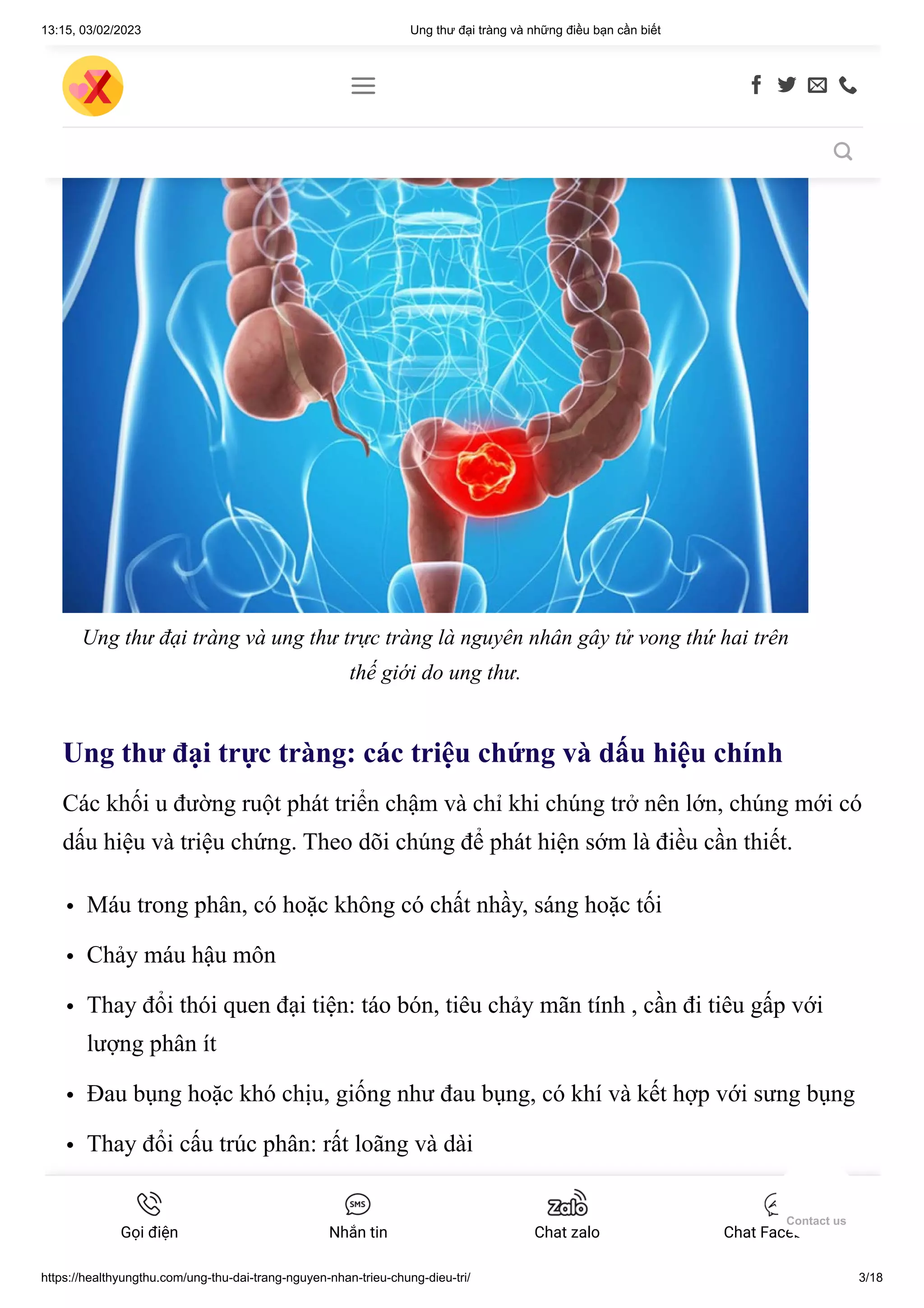 Ung thu dai trang Nhung dieu can biet | PDF