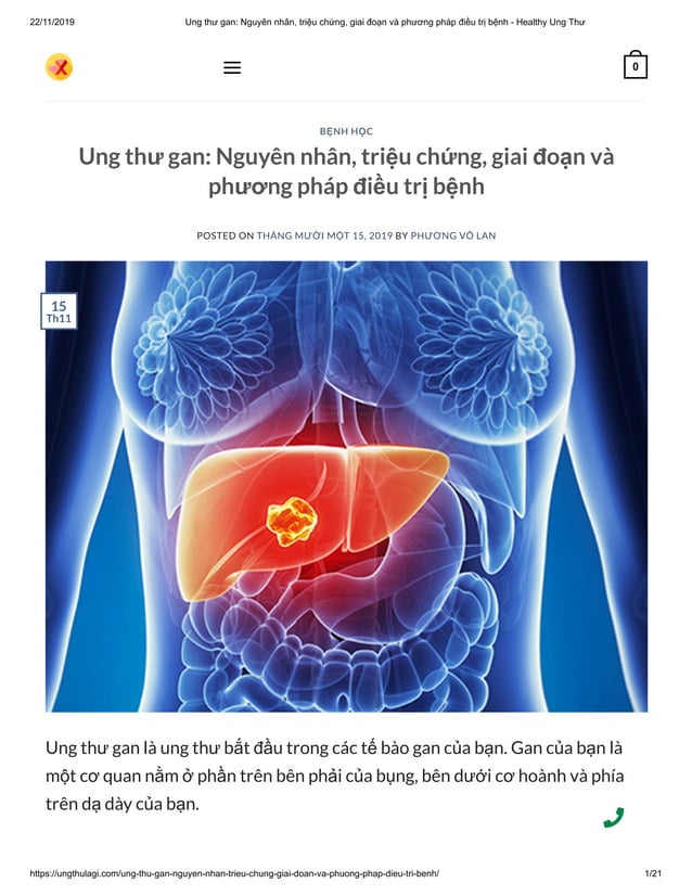 Ung thu gan nguyen nhan dau hieu trieu chung phuong phap dieu tri hieu qua nhat | PDF