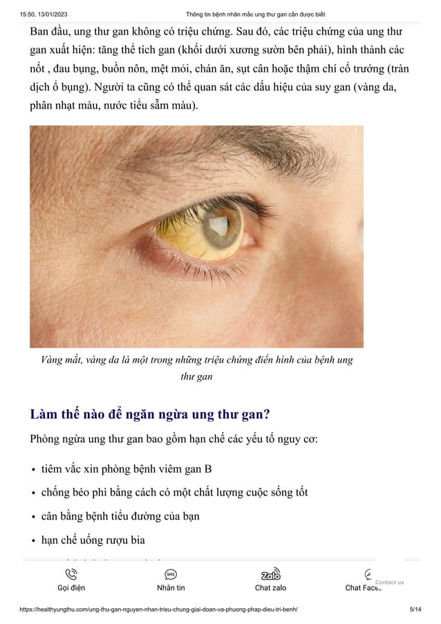 Ung thu gan Nguyen nhan trieu chung va dieu tri | PDF