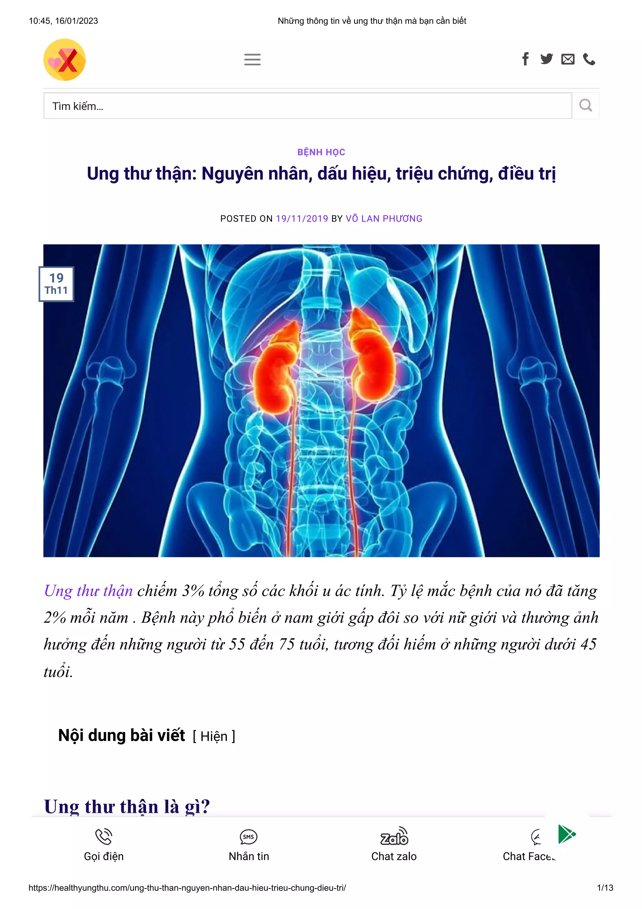 Ung thu than Nguyen nhan dau hieu chan doan va dieu tri.pdf