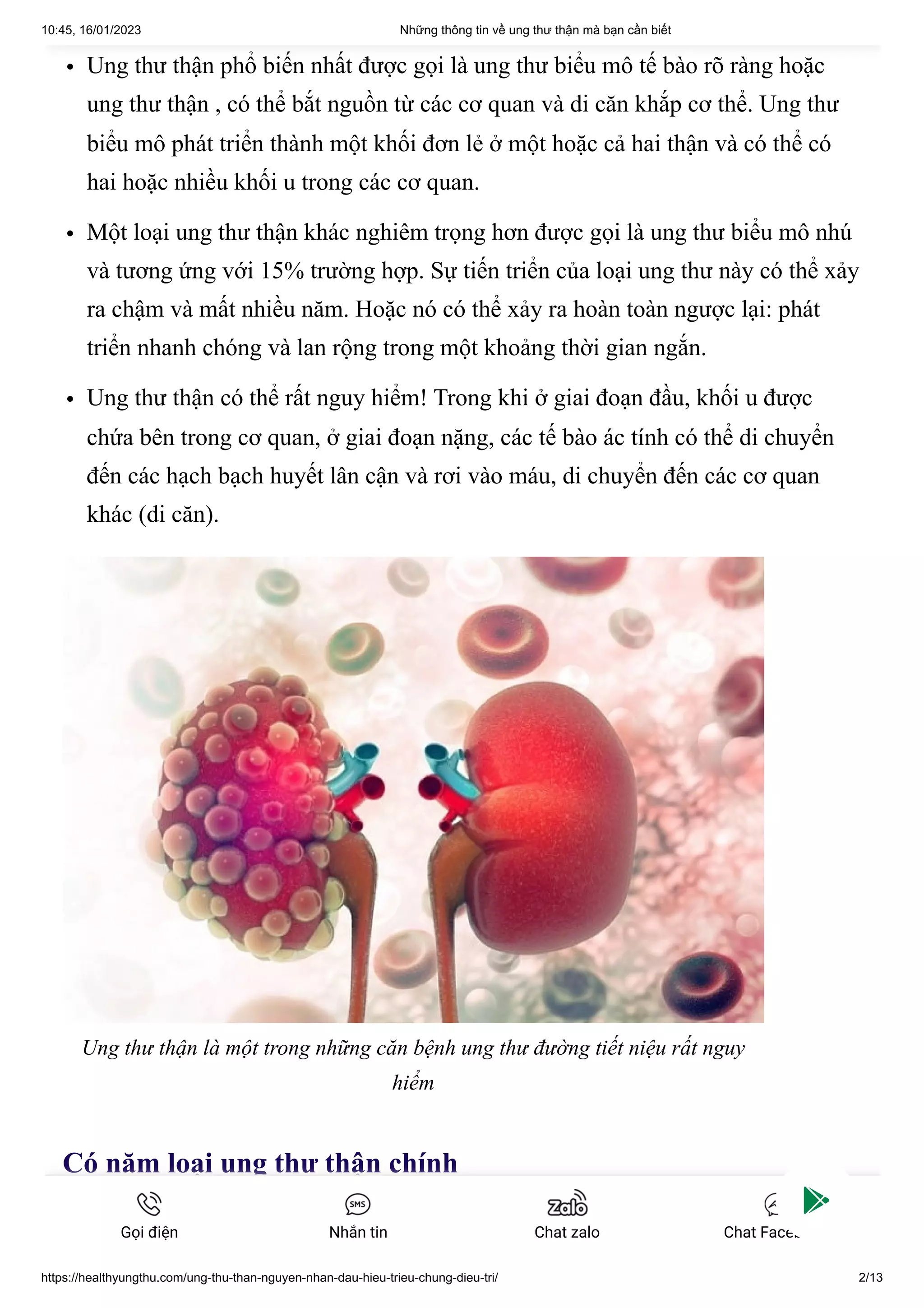 Ung thu than Nguyen nhan dau hieu chan doan va dieu tri.pdf