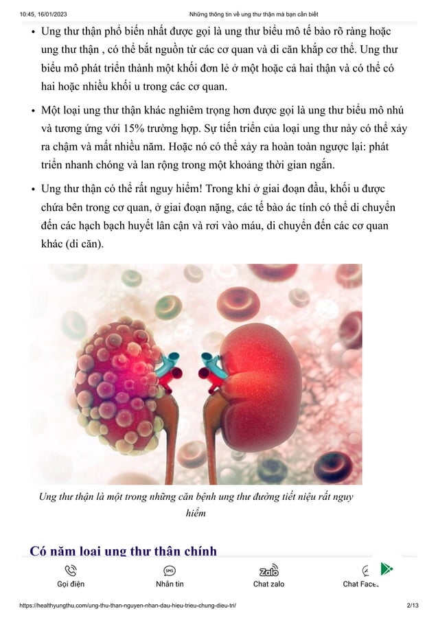 Ung thu than Nguyen nhan dau hieu chan doan va dieu tri.pdf