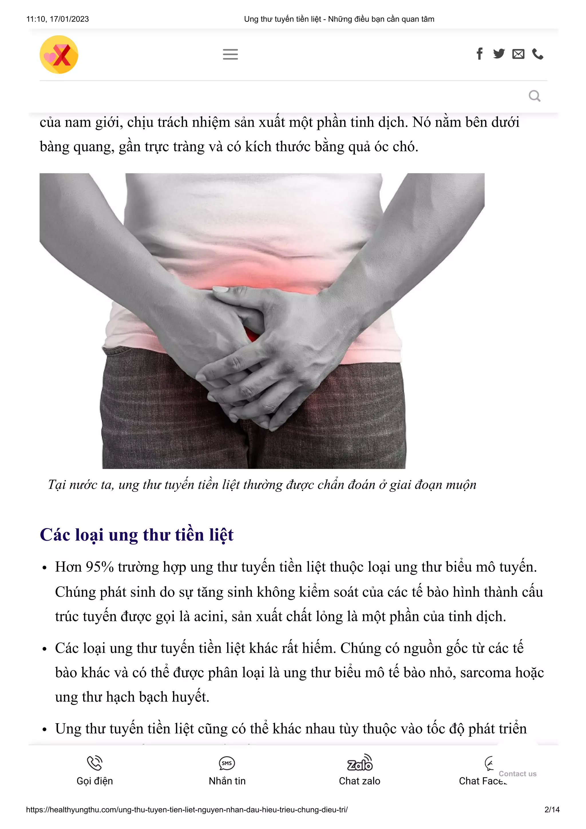 Ung thu tuyen tien liet Nguyen nhan dau hieu va cach dieu tri.pdf