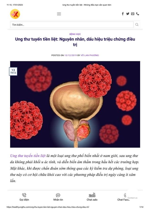 Ung thu tuyen tien liet Nguyen nhan dau hieu va cach dieu tri.pdf