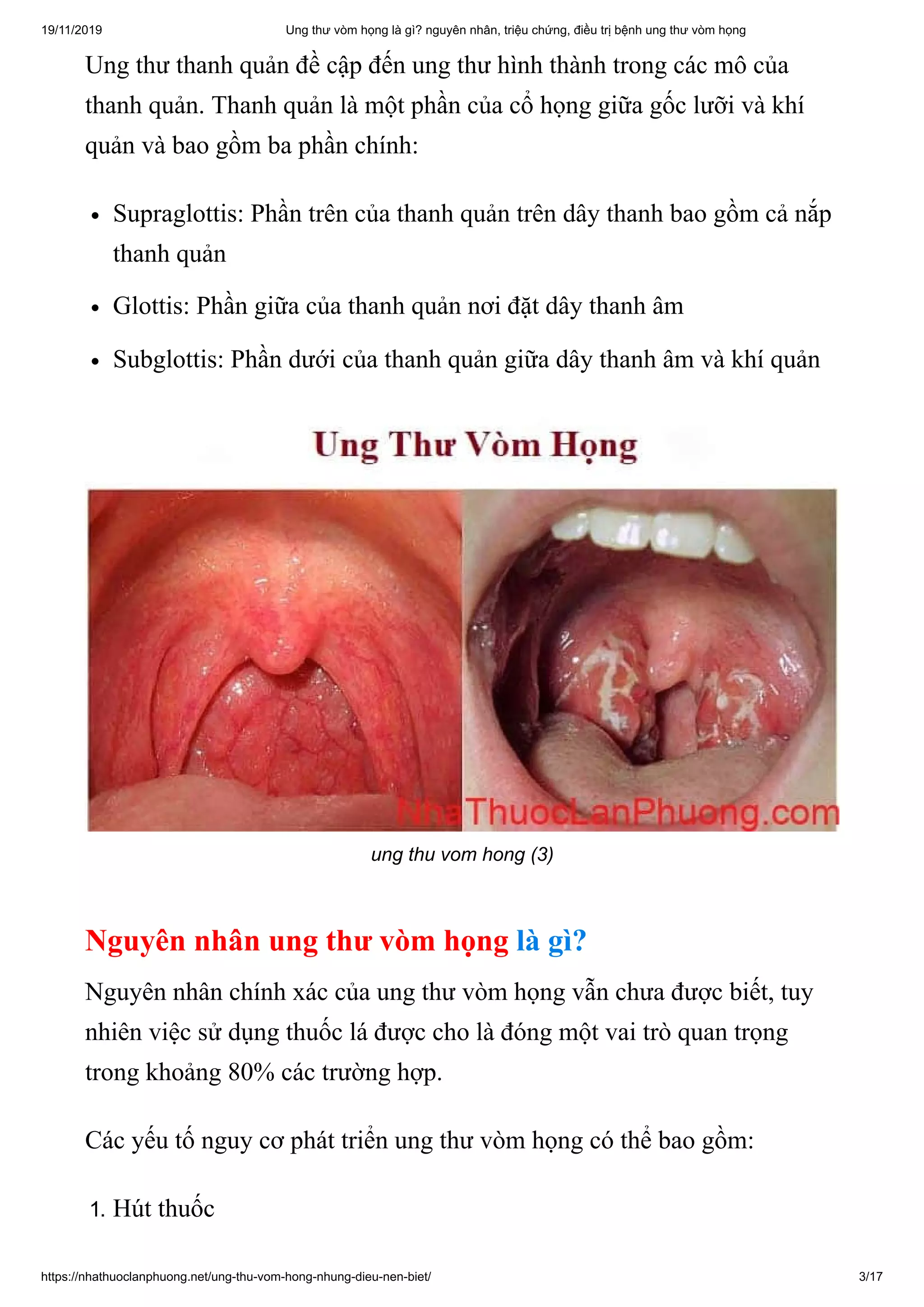 Ung thu vom hong la gi | PDF