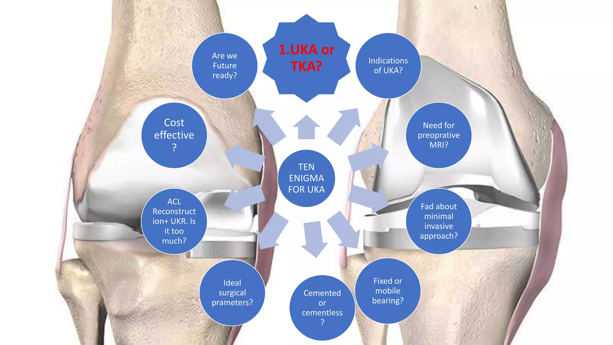 Unicompartmental knee arthroplasty | PPTX