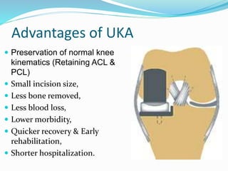 Unicondylar knee replacement | PPTX