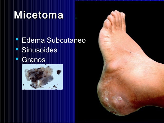 Unidad 2 Clase 5 Dermatologia Tropical