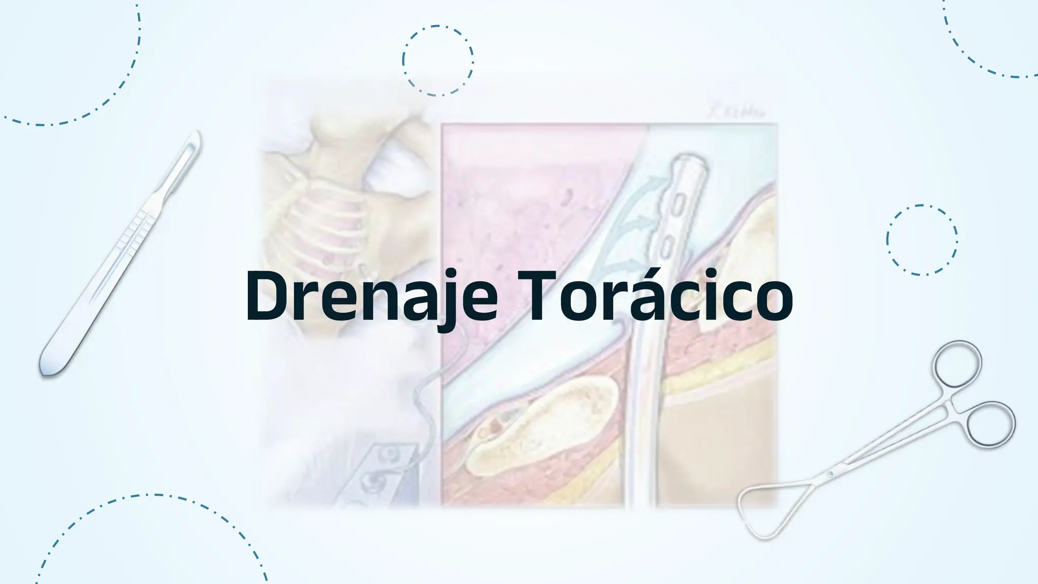 Procedimiento de Drenaje Torácico y generalidades | PDF