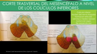Sistema nervioso central(Tallo cerebral) | PPTX