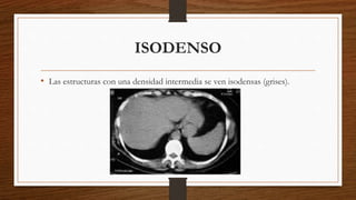 Unidad 3 terminologia en tac | PPTX