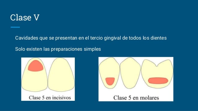 UNIDAD VI ODONTOLOGÍA ADHESIVA