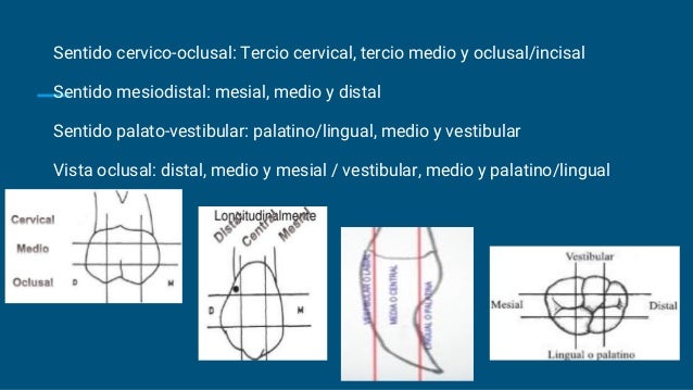 UNIDAD VI ODONTOLOGÍA ADHESIVA