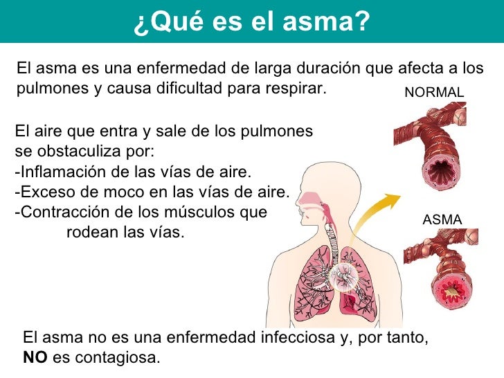 Unidad Didáctica Asma 2