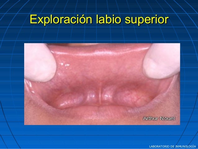 METODOS DE EXPLORACIÓN Y DIAGNÓSTICO EN PATOLOGÍA BUCAL