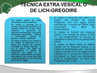 Unidad n° 3 PROCEDIMIENTOS QUIRÚRGICOS EN URETER | PPTX