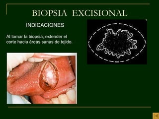 Principios de biopsia y diagnostico precoz de cancer | PPT