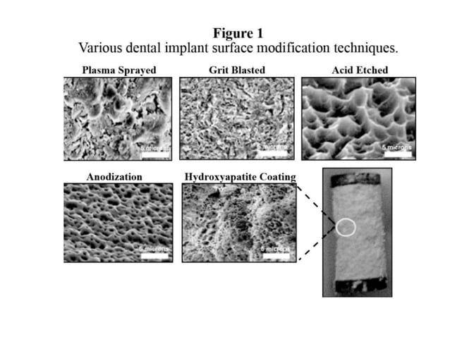 Dental implant principles | PPTX