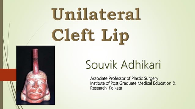 Unilateral cleft lip | PPTX