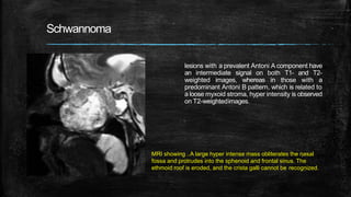 Unilateral Nasal Mass | PPTX