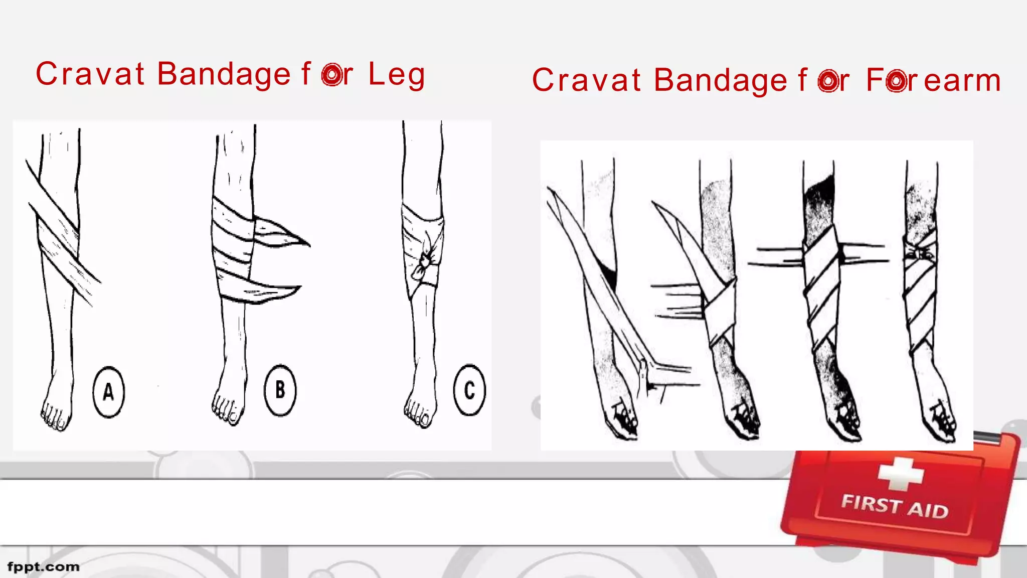 Unintentional Injuries.pptx