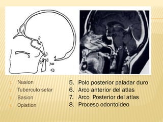 Anatomía de la Unión Craneocervical.pptx