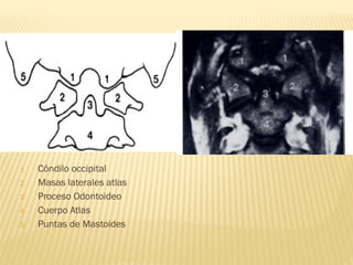 Anatomía de la Unión Craneocervical.pptx