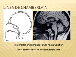 Anatomía de la Unión Craneocervical.pptx