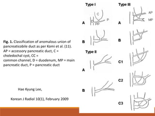 Union pancreatobiliar anomala. dr. miguel chávez r | PDF