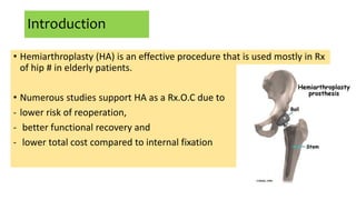 Bipolar Hemiarthroplasty Vs Unipolar Hemiarthroplasty