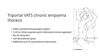 open vs VATS decortication | PPTX | Physical Therapy | Wellness