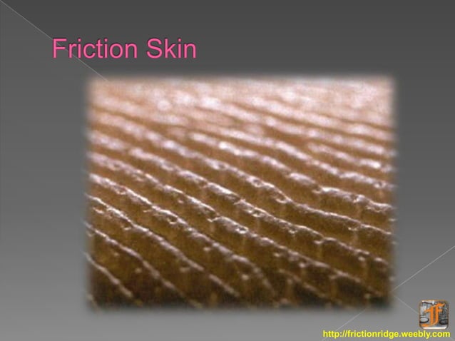 Uniqueness and permanence of friction ridge | PPSX | Skin and ...