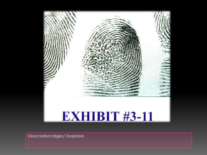 Uniqueness and permanence of friction ridge