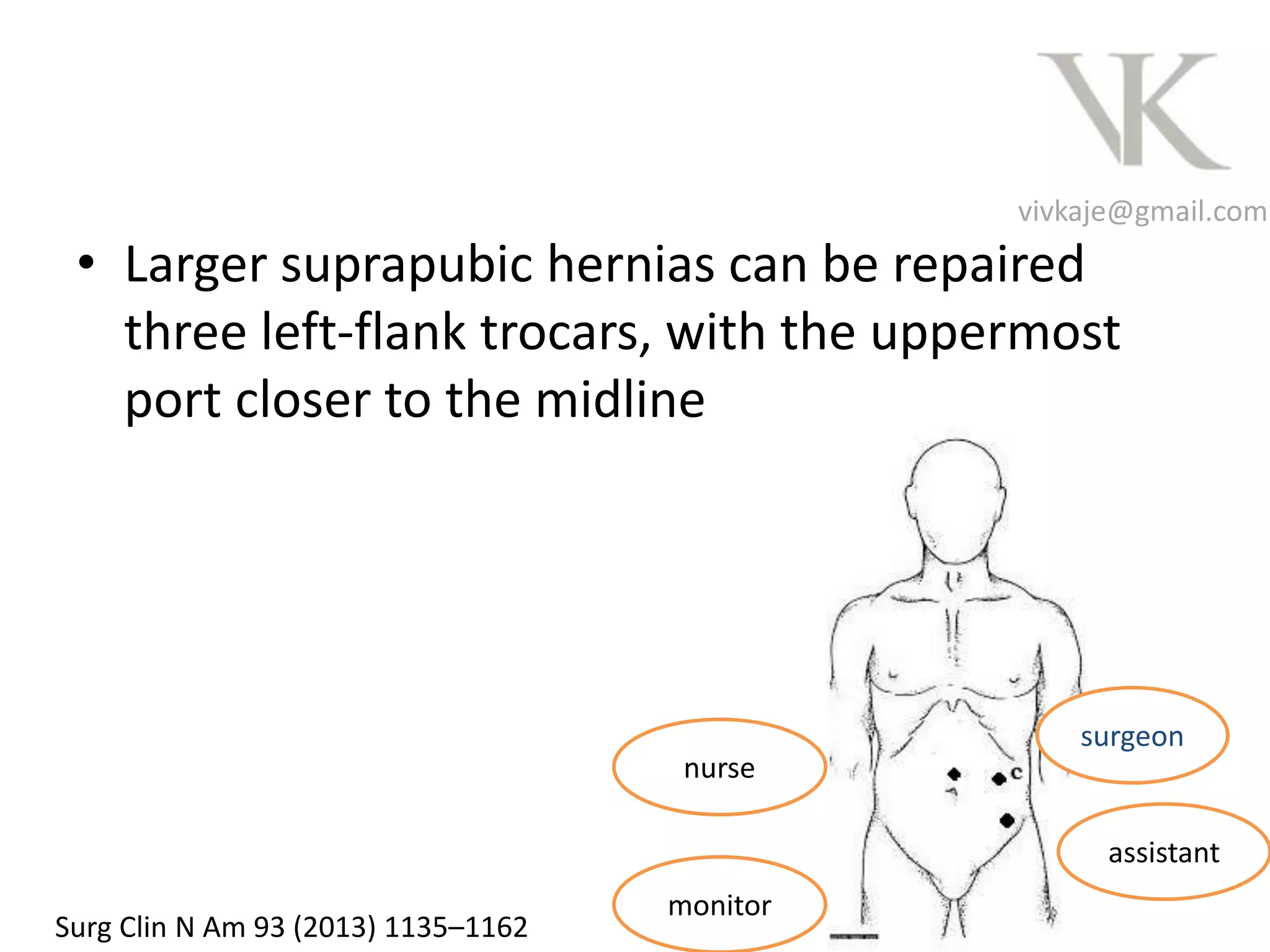 Suprapubic hernia - Unique Features | PPTX