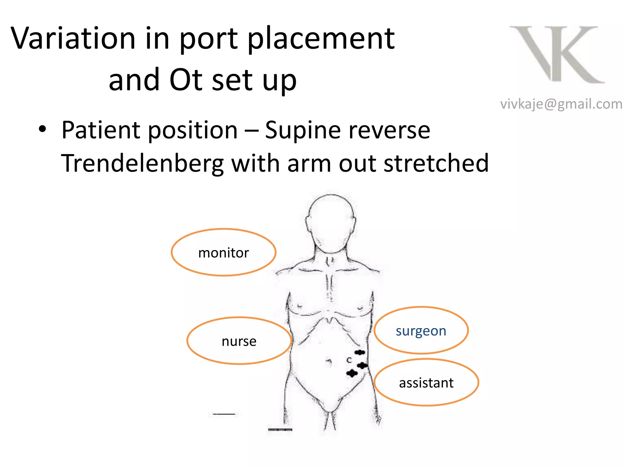 Suprapubic hernia - Unique Features | PPTX