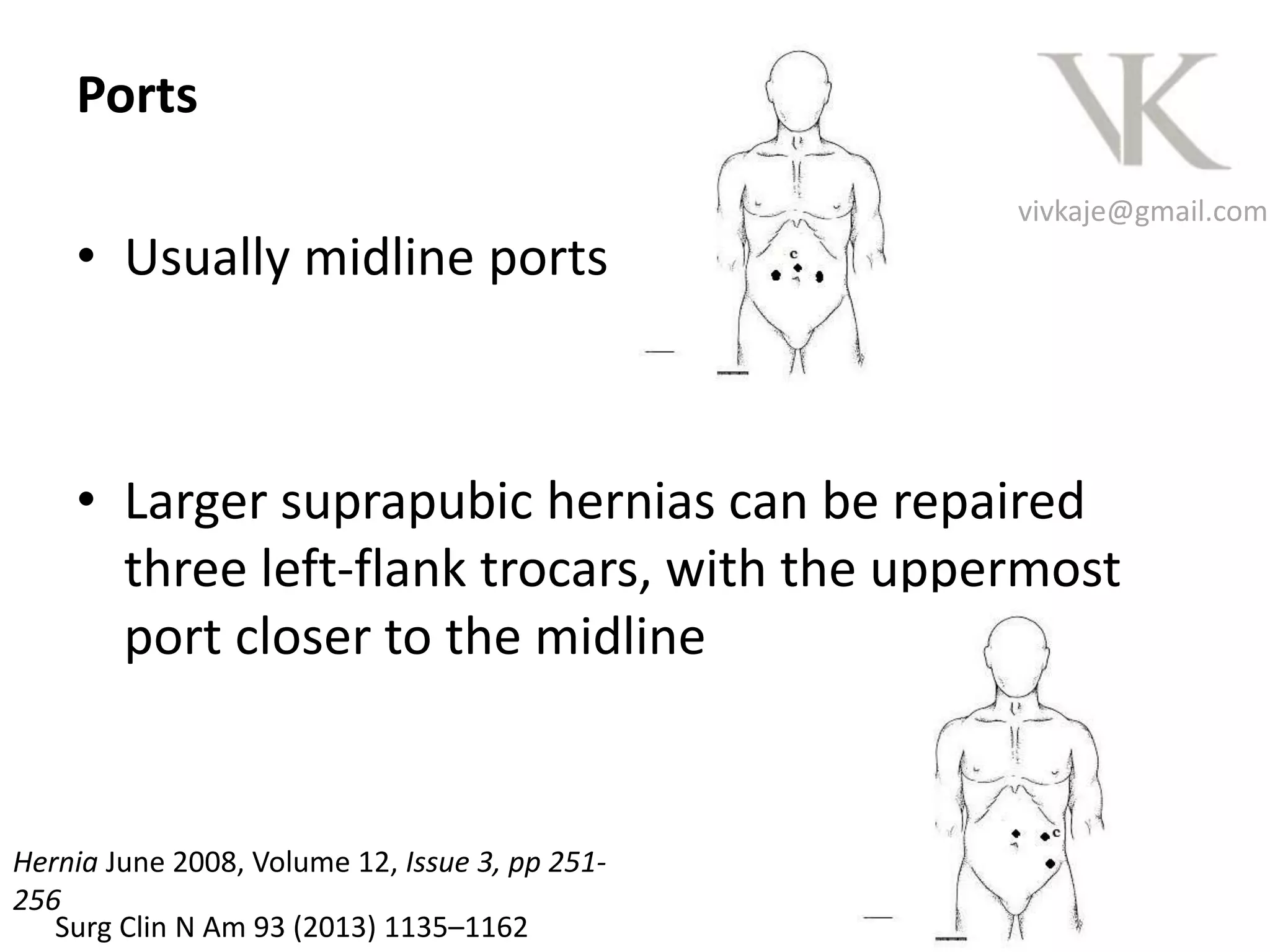 Suprapubic hernia - Unique Features | PPTX
