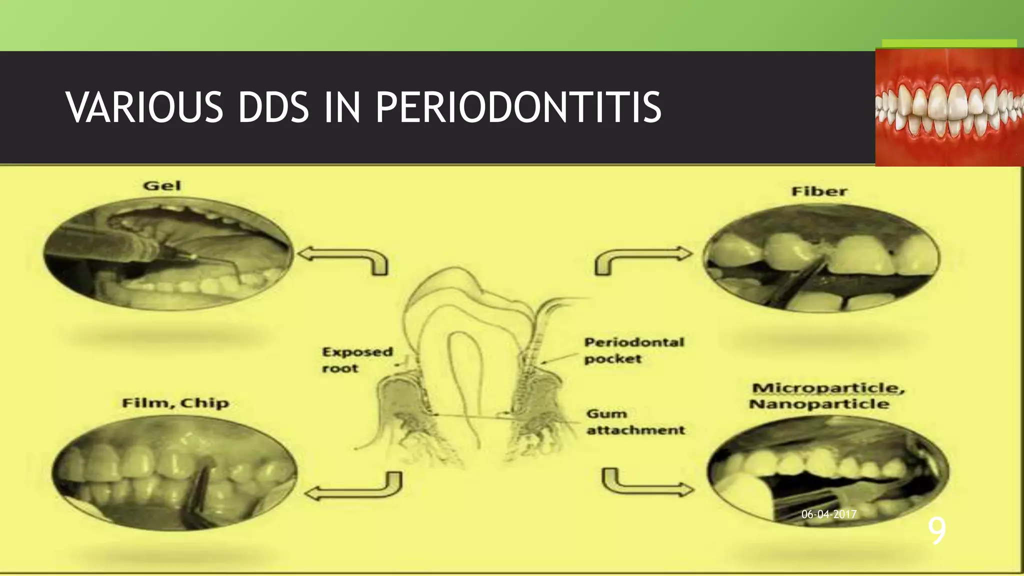 advances in treatment of periodontitis DDS | PPTX