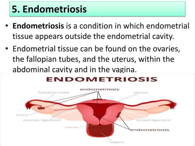 Unit-04 Part (A) Female Reproductive Disorders Provided By Khyber ...