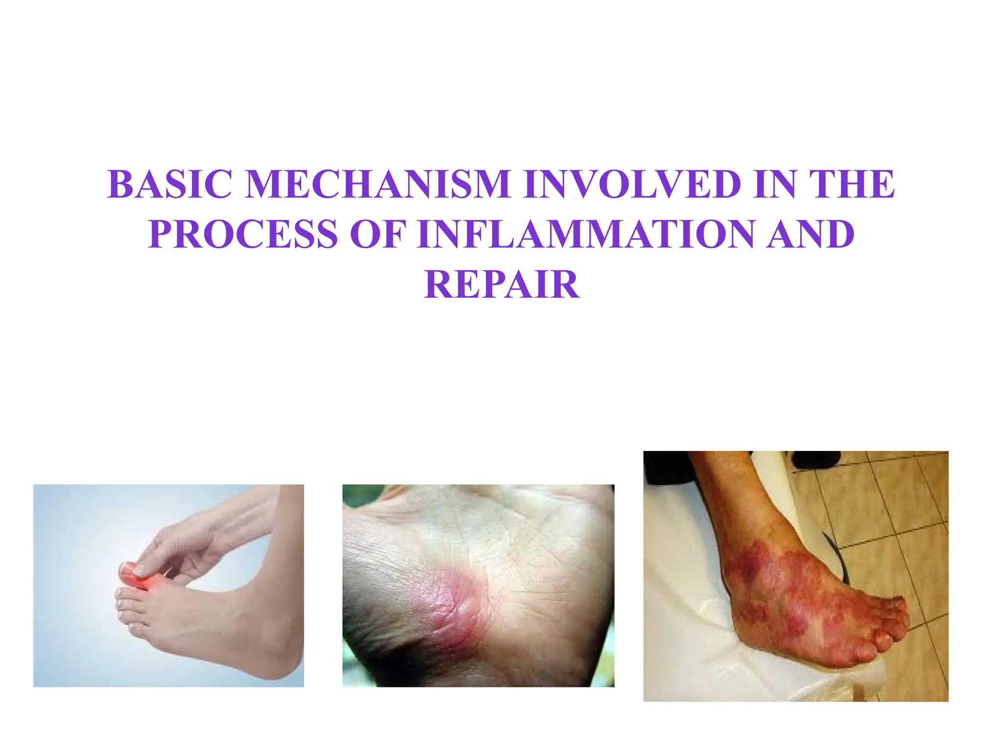 unit-1-basic-mechanism-involved-in-the-process-of-inflammation_compress.pdf
