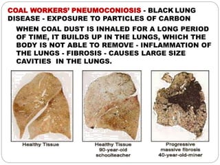 Occupational and industrial health disorder | PPTX